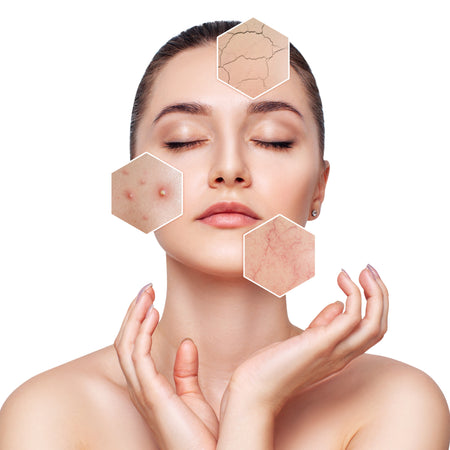 Skin Smoothing Body Lotion – Reversa